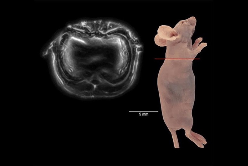 Photoacoustic Imaging Shows Mouse Brain at Work | RealClearScience