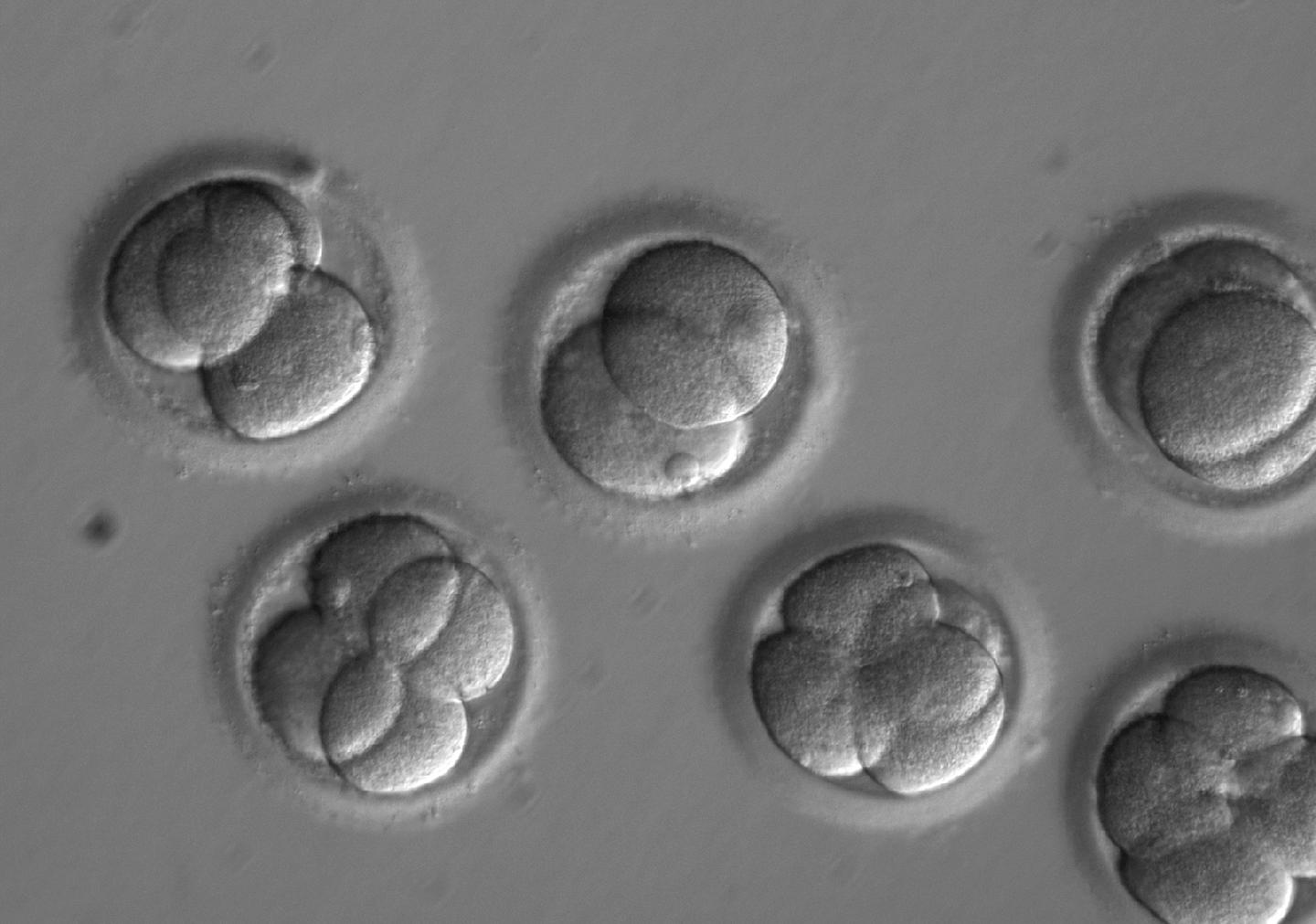 Artificial Human Embryos Are Coming | RealClearScience