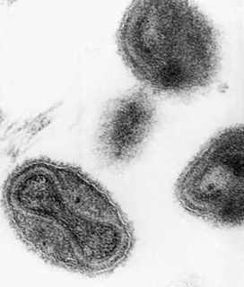 When Smallpox Almost Came Back From the Dead | RealClearScience