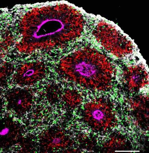 The New Field of Sonogenetics Uses Sound Waves to Control the Behavior ...