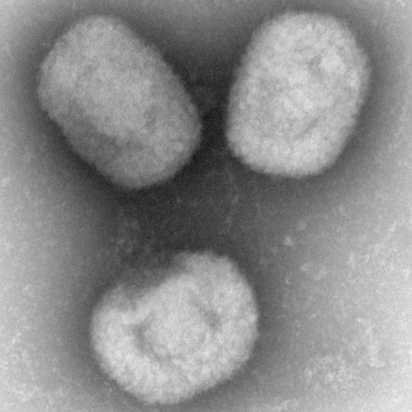 Controversial Paper Shows How to Make Pox Virus | RealClearScience