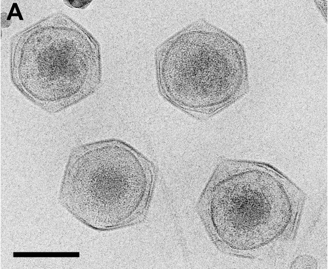 How a Virus Forms Its Symmetric Shells | RealClearScience