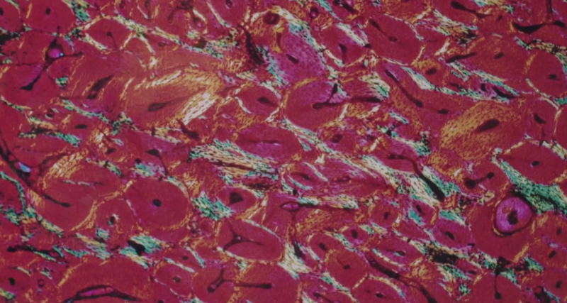 What a Dinosaur Looks Like Under a Microscope | Video | RealClearScience