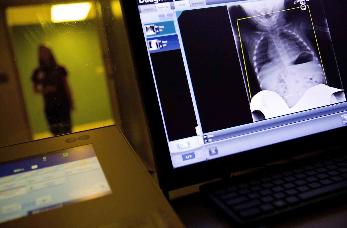 X-Ray 'Ghost Images' Could Cut Radiation Doses | RealClearScience