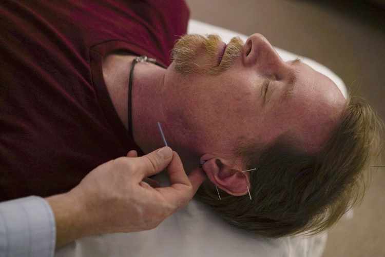 A New Acupuncture Study Is One of the Worst Studies I Have Ever Seen ...