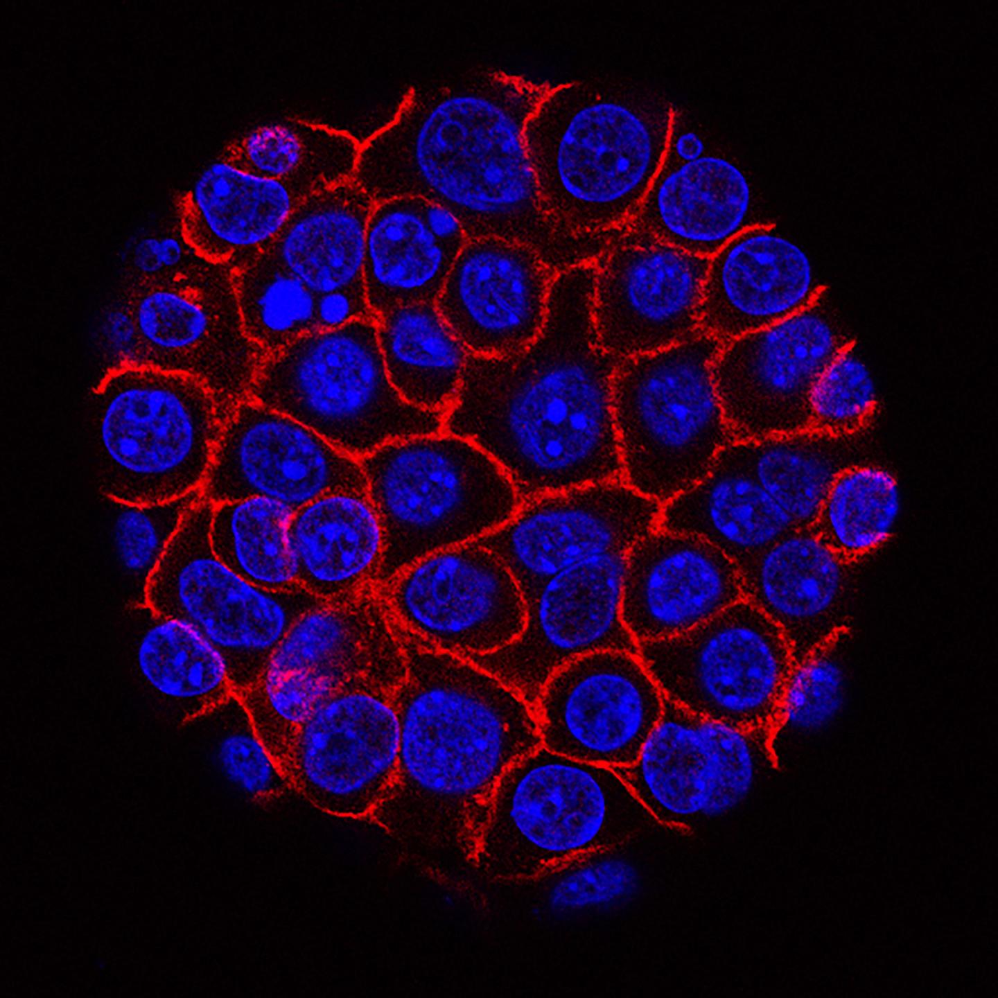 Are All Cancer Cells The Same RealClearScience