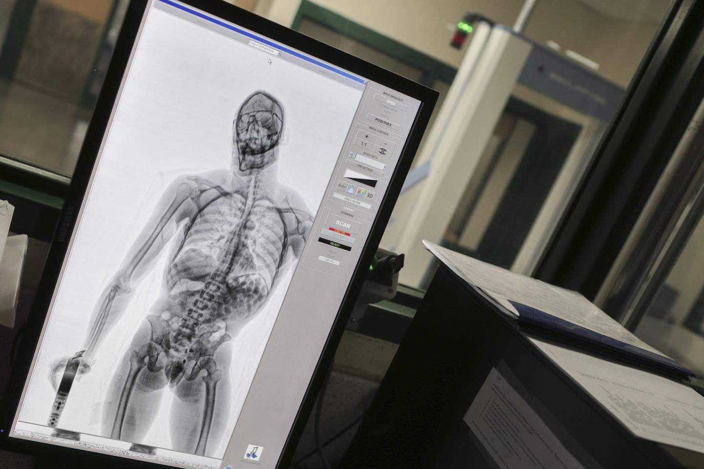 New Fundamental Knowledge of the "Abdominal Brain" | RealClearScience