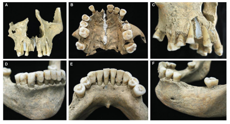 What's So Controversial About a Medieval Nun's Teeth? | RealClearScience