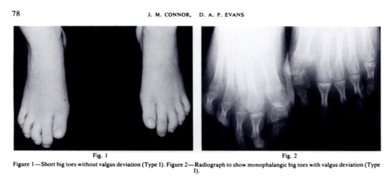 Harry Raymond Eastlack