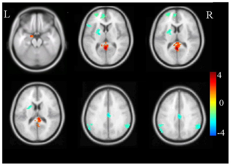 Brain Scans Reveal 'Tipping Point' Just Before Falling Asleep ...
