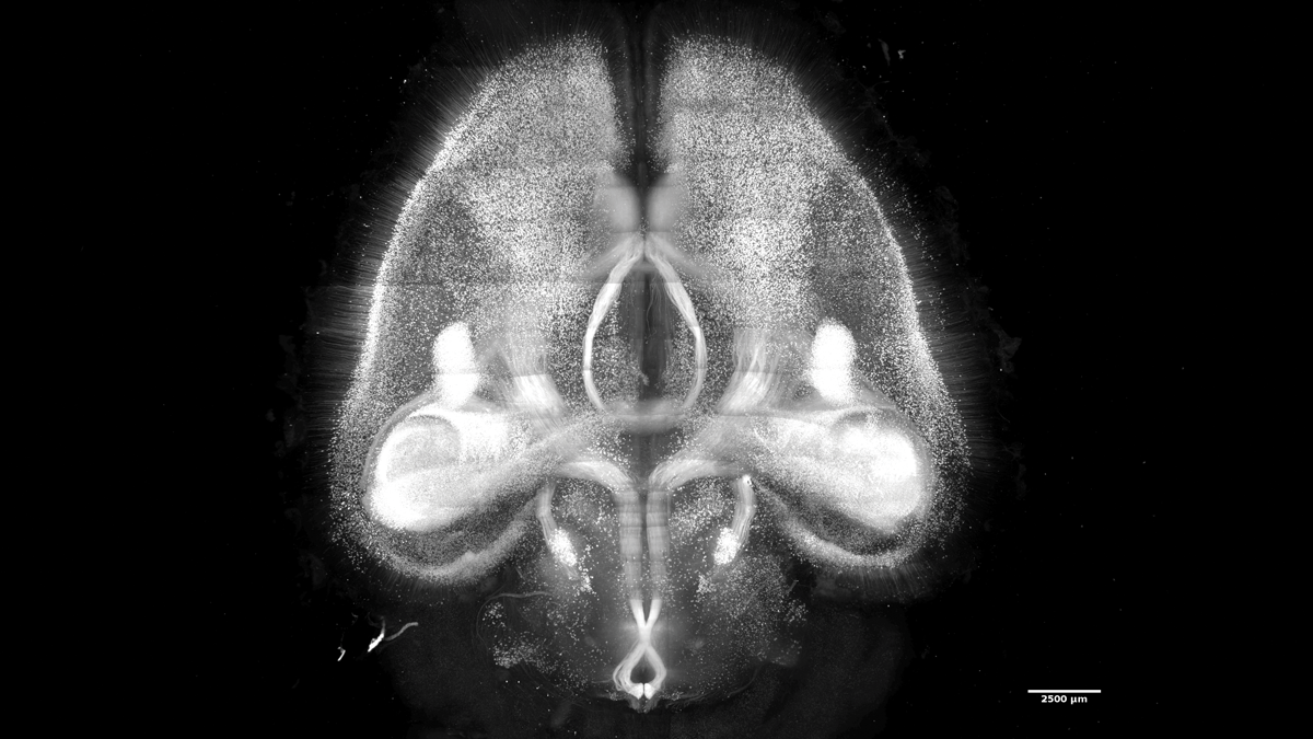 New Tissue Clearing Methods Offer a Window Into the Brain ...