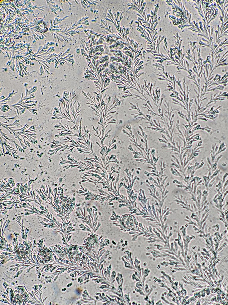 Cervical Mucus Is Both Amazing and Beautiful | RealClearScience