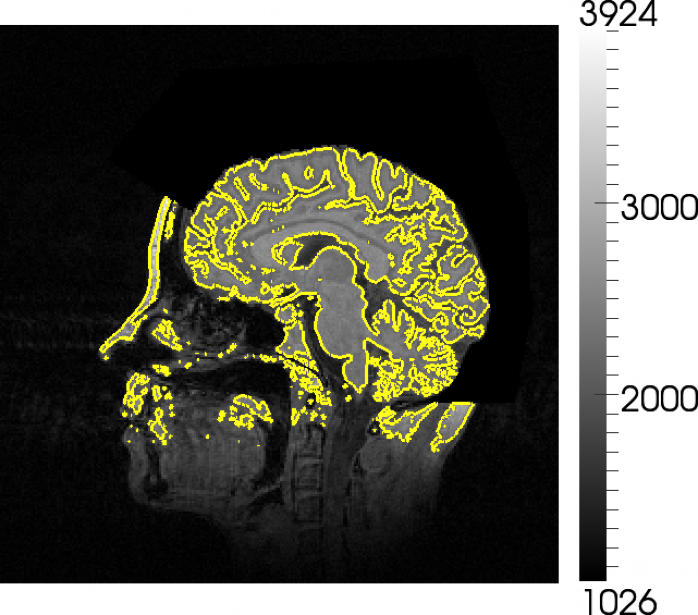 Captured Images of Dying Man's Brain Activity | RealClearHealth