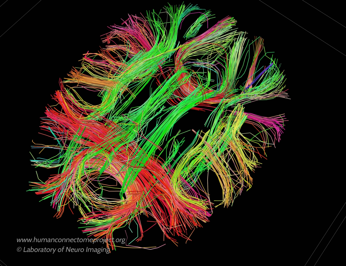 Using Machine Learning To Map The Brain RealClearScience Using Machine Learning To Map The Brain RealClearScience
