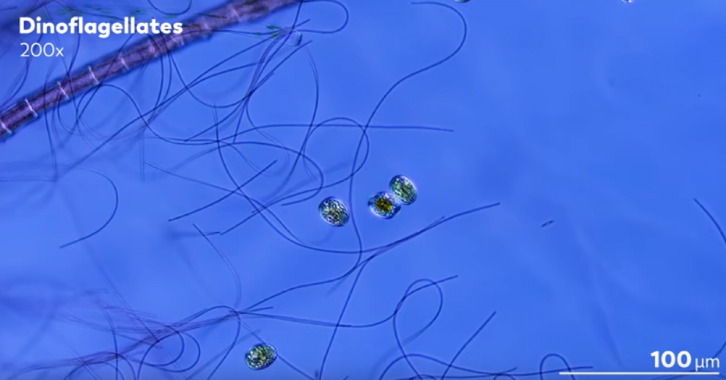 Dinoflagellates: The Algae That Saved an Astronaut | RealClearScience