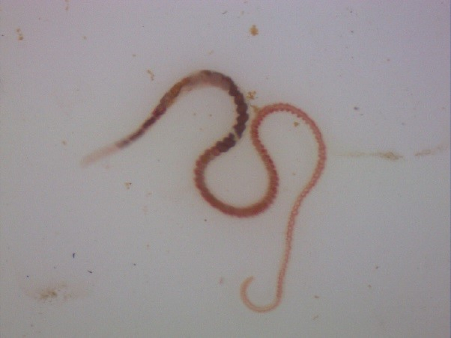 Cave Worms Could Hold the Secrets to a Better Life | RealClearScience