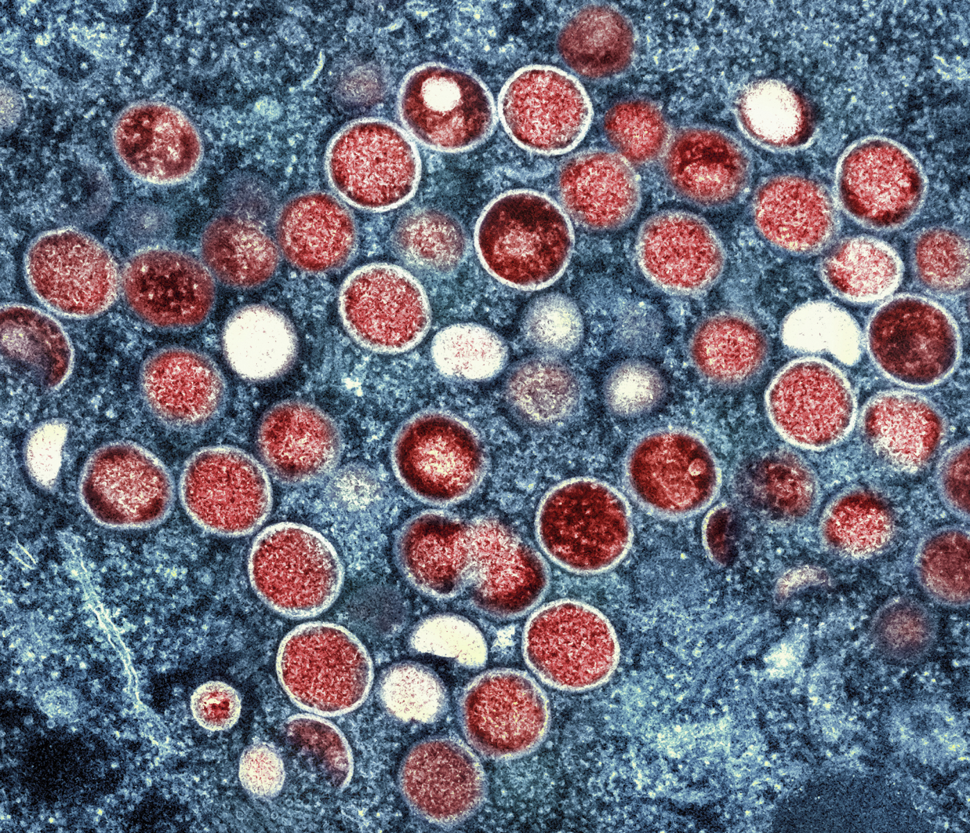Scientists Find New Way Viruses Can Spread Around the Body ...