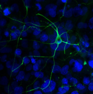 The Largest Map of the Human Brain Ever Made | RealClearScience