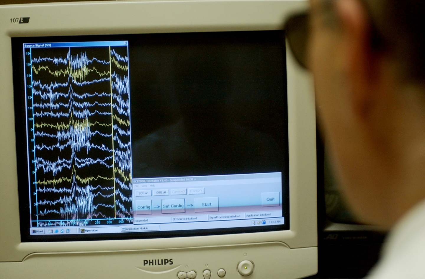 What Are Brain States and Can We Control Them? | RealClearScience