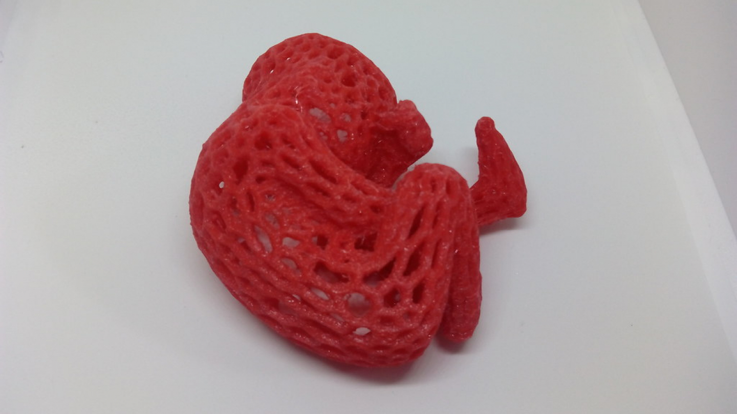 Fetal Cell Organoids Grown From Amniotic Fluid | RealClearScience