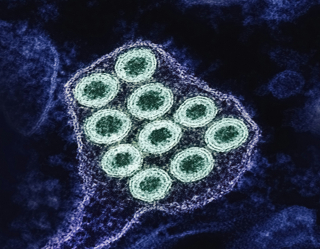 The Tale of the Mad Stone, the One-Time 'Cure' for Rabies ...