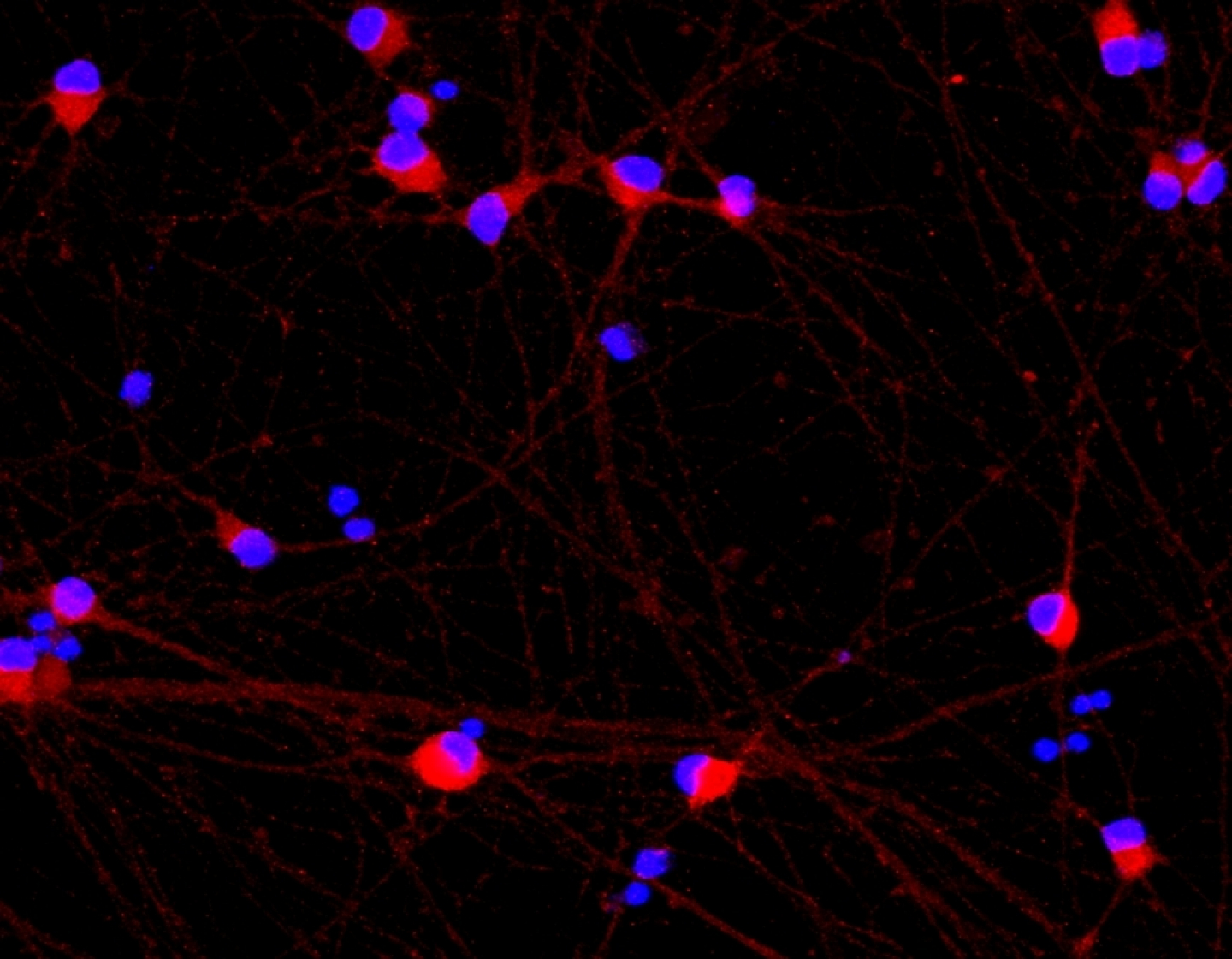 Controversial Study Redraws Classical Picture of the Neuron ...