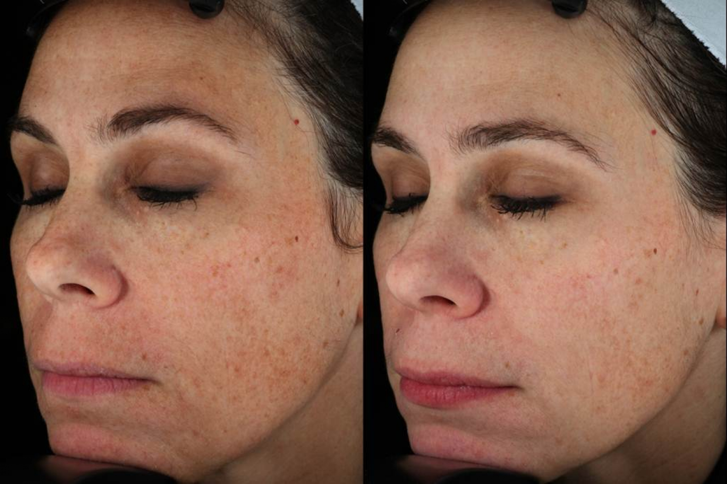 The Real Science Behind the Billionaire Pursuit of Immortality ...