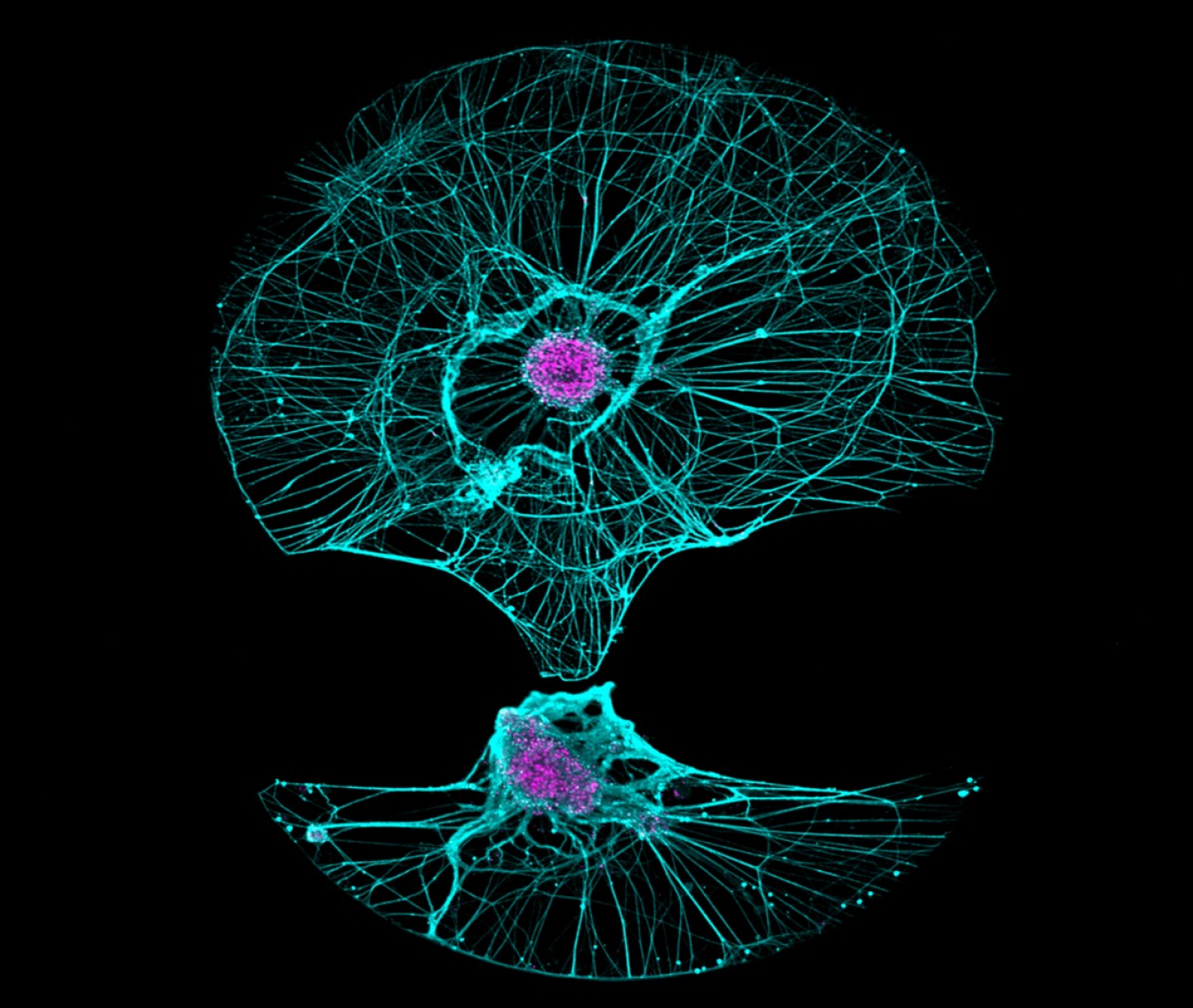 The Prefrontal Cortex Shapes How Other Brain Regions Function ...