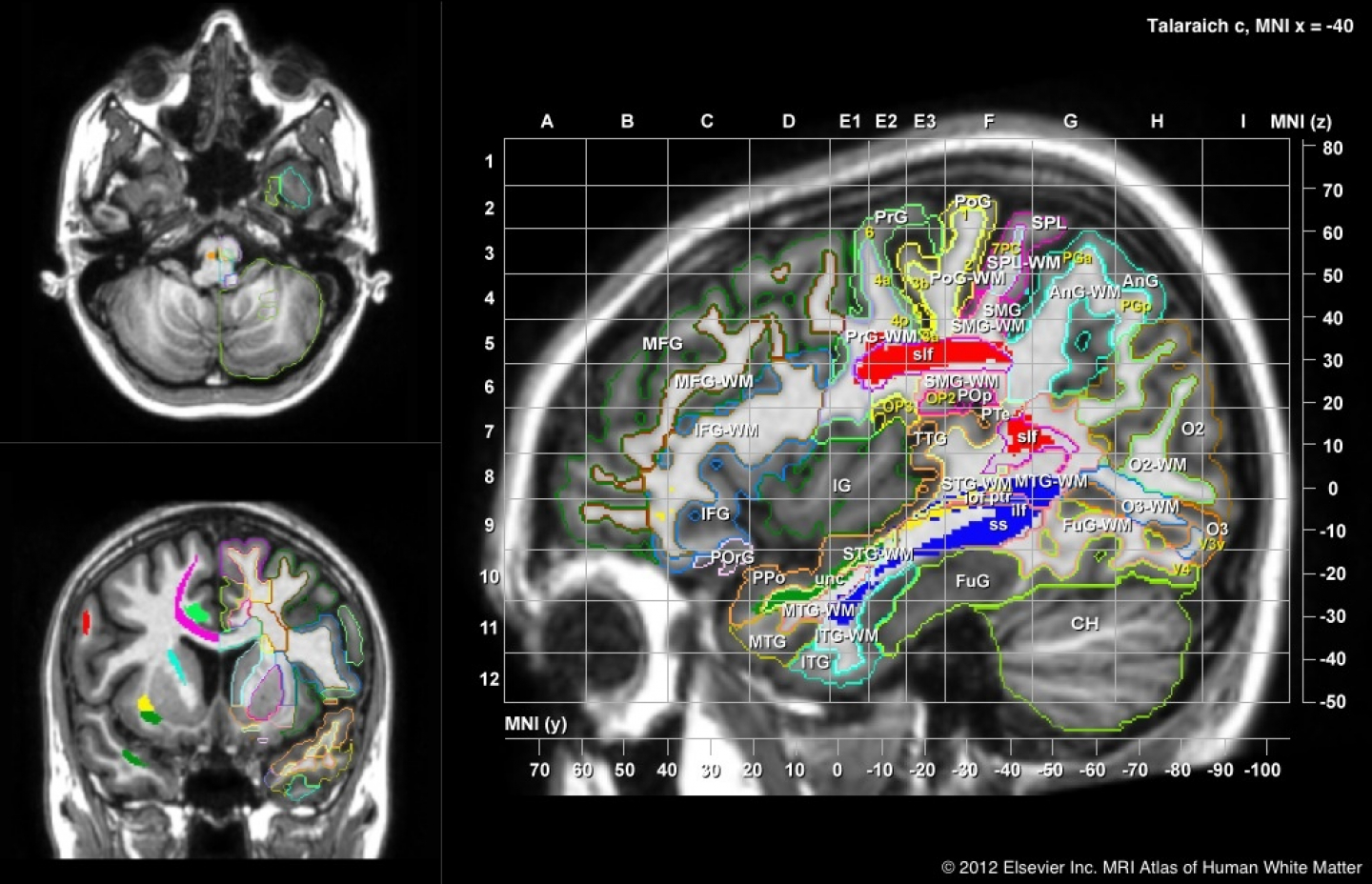 The Scientist Unraveling the Mysteries of Gray Matter | RealClearScience