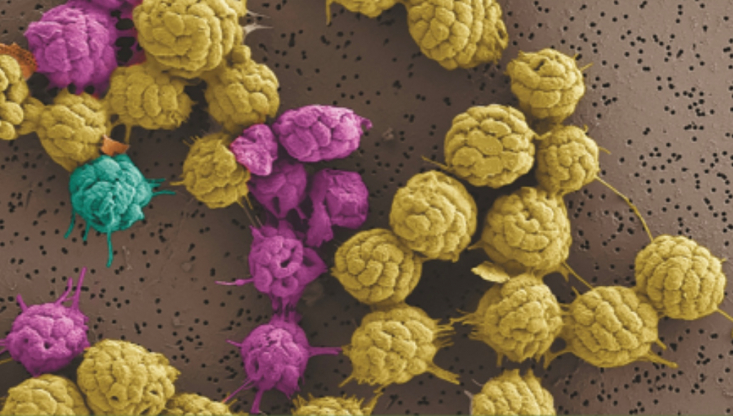 Bacteria That Can't Live Alone Show Early Steps to Complex Life ...