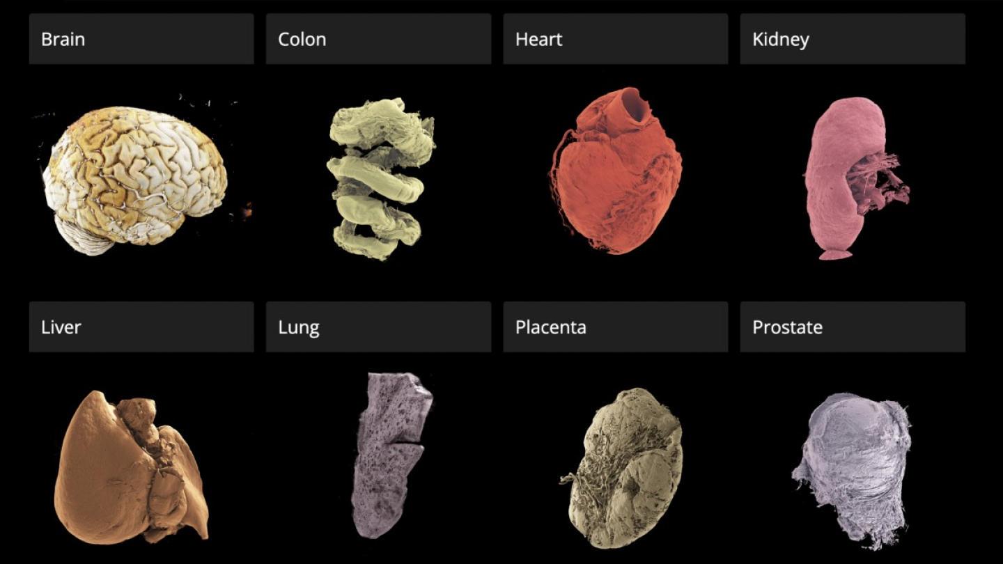 See Human Organs Imaged in Greater Detail Than Ever | RealClearScience